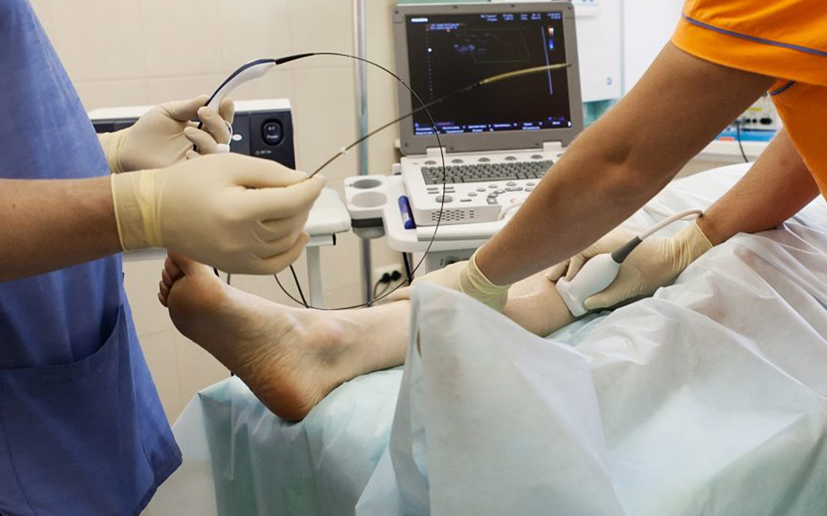 Radiofrequency Surgery | Op. Dr. Murat Ertürk